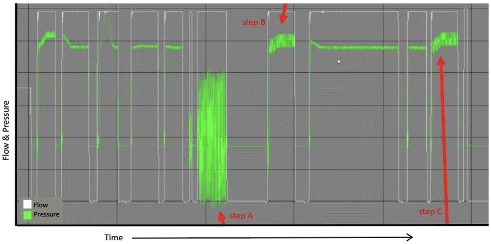 Pulsation in peristaltic pumps and positive displacement pumps